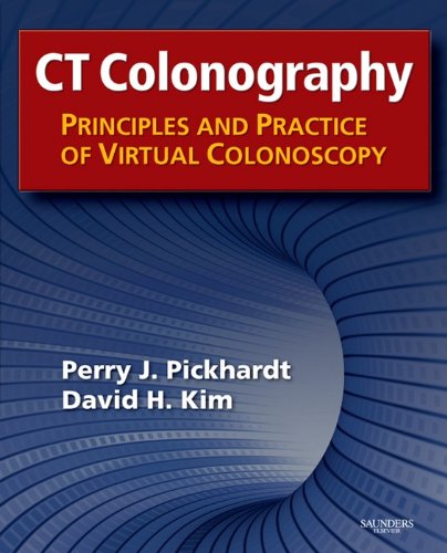 Amazon.com: CT Colonography: Principles and Practice of Virtual ...