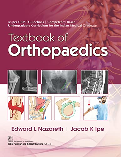 Textbook of Orthopaedics eBook : Nazareth, Edward L., Ipe, Jacob K ...
