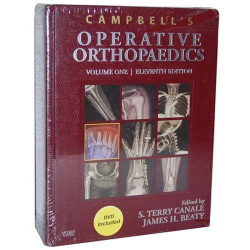 Campbell's Operative Orthopaedics (Volume 1 Only) (Volume 1): unknown ...