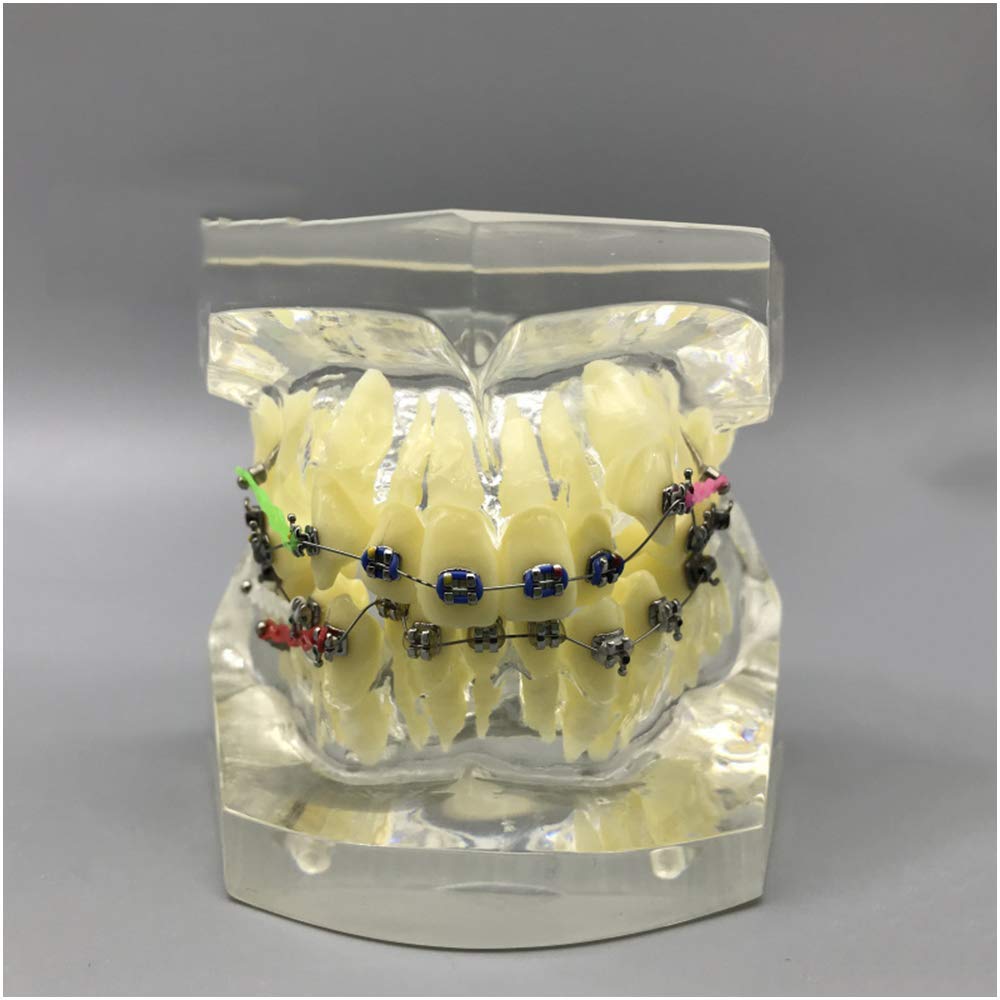 Buy Dental Teeth Orthodontic Model - Teeth Model for Education Model ...
