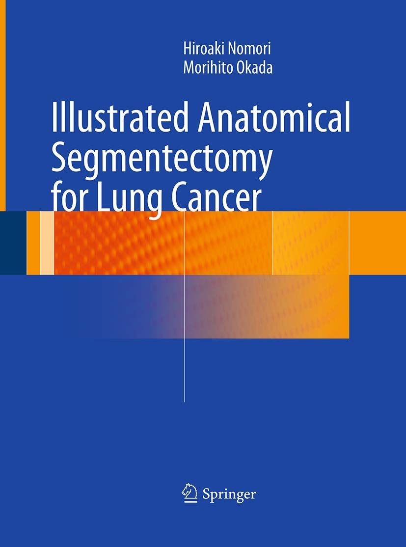 Snapklik.com : Illustrated Anatomical Segmentectomy For Lung Cancer