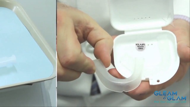 Watch Effectiveness of Gleam&GLam Teeth Whitening Kit on Amazon Live