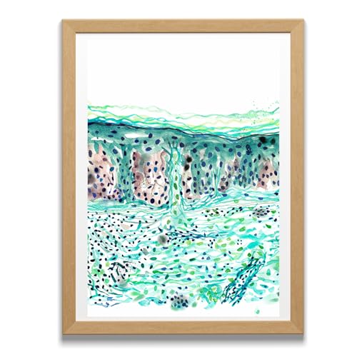 Amazon.com: Melanoma Abstract Pathology Dermatology Art Print ...