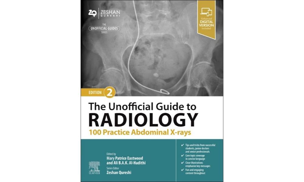 The Unofficial Guide to Radiology: 100 Practice Abdominal X-rays ...