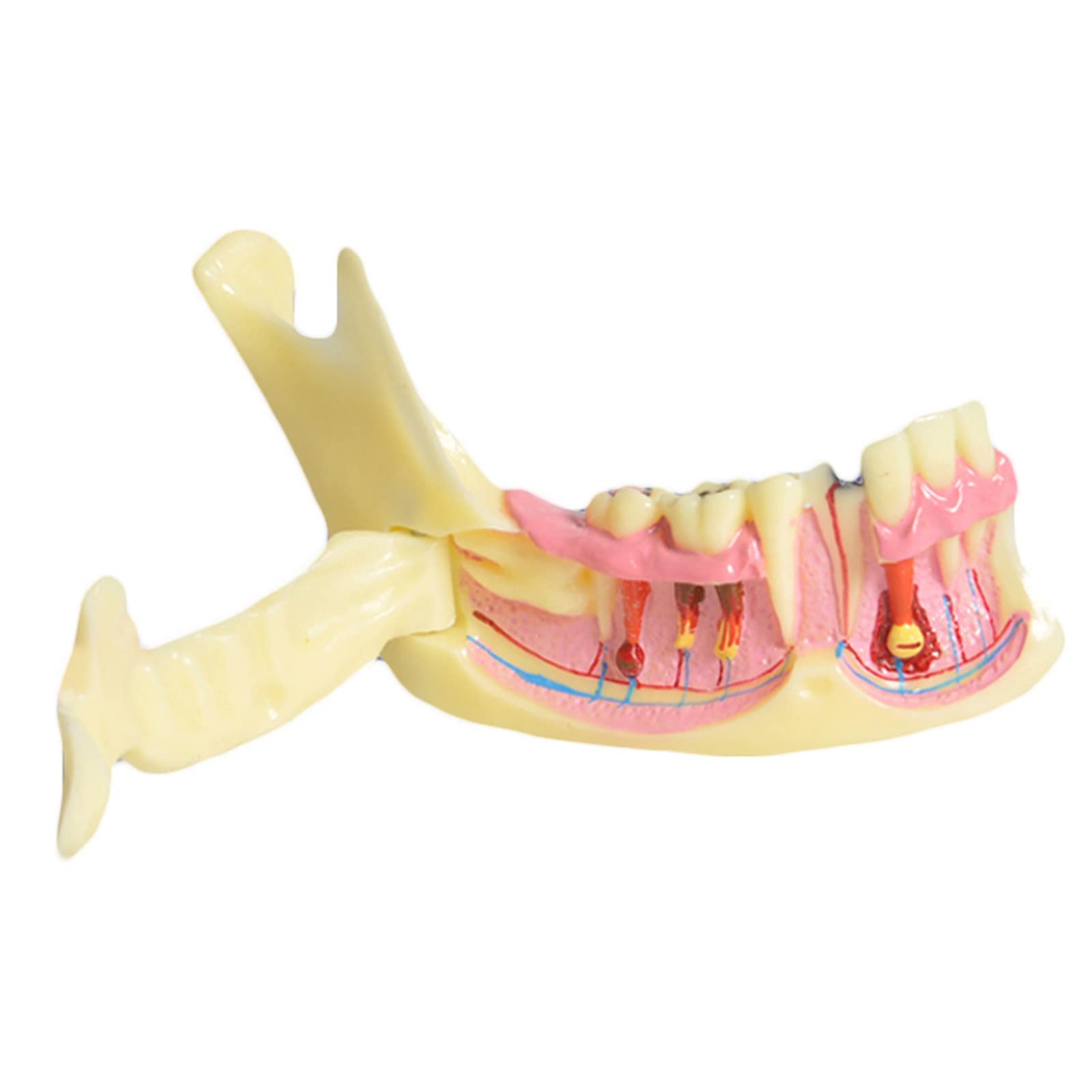 Buy Lower Jaw Teeth Study Model Mandibular Mandibular Tissue ...