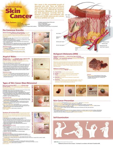 Amazon | Understanding Skin Cancer Anatomical Chart | Dermatology