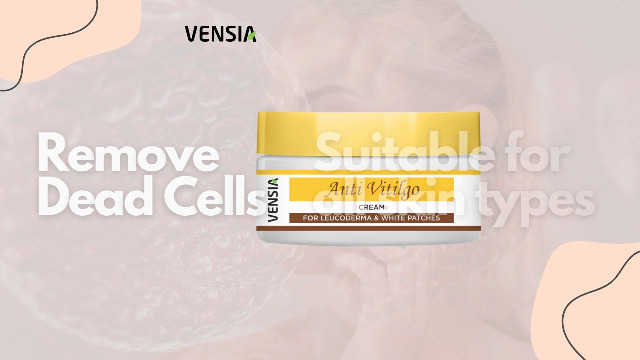 Watch VENSIA Anti Vitiligo cream on Amazon Live