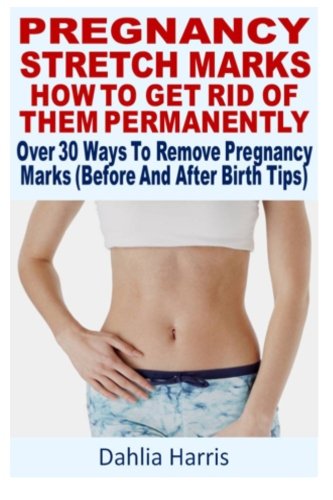 Buy Pregnancy Stretch Marks : How To Get Rid Of Them Permanently: Over ...