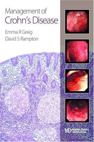 Management of Crohn's Disease: Greig, Emma, Rampton, David ...