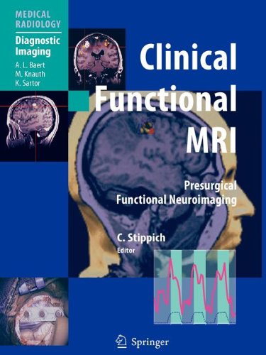 Clinical Functional MRI : Amazon.co.uk: Books