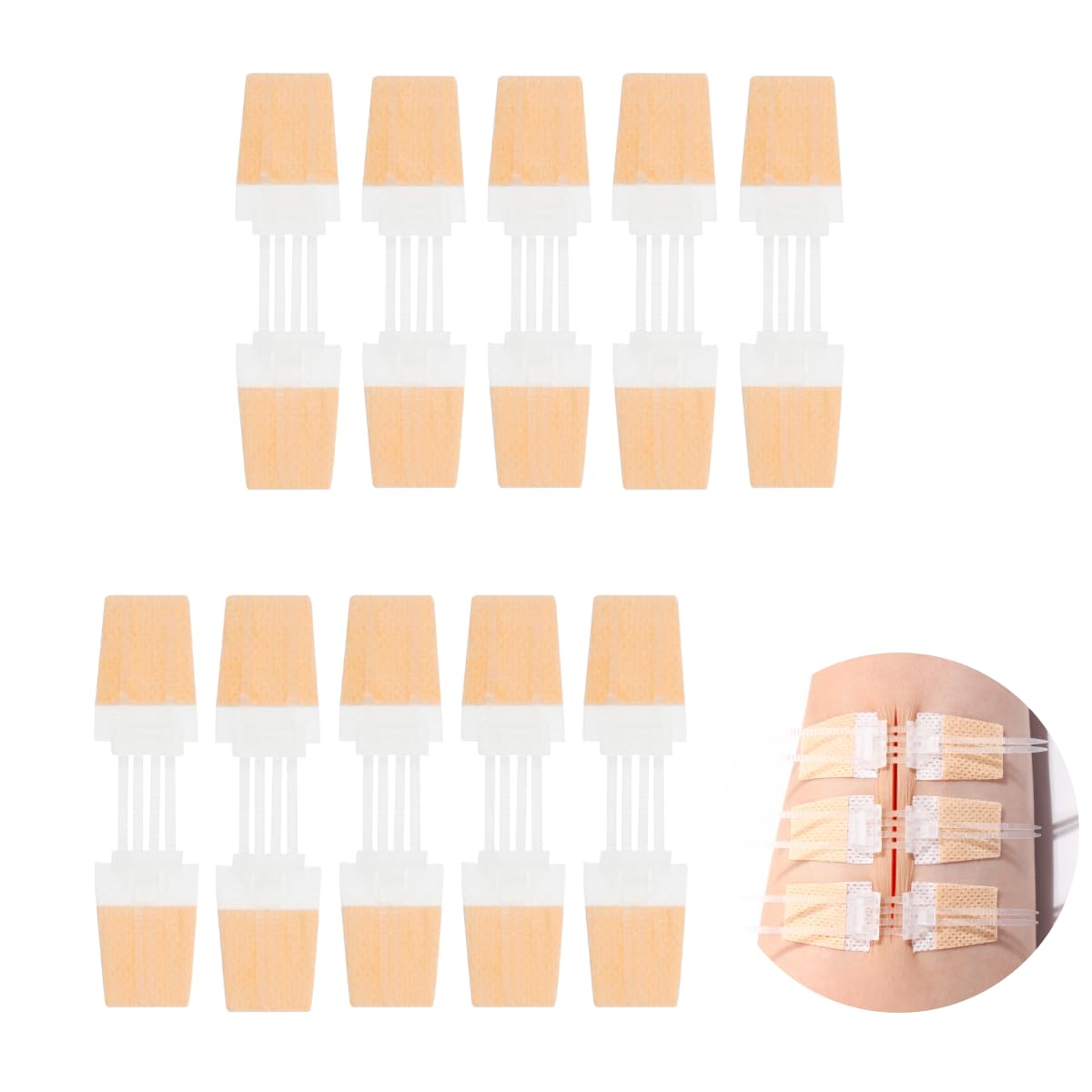 Buy Longmed Emergency Wound Closures - 10 Pcs Zipper Wound Closure ...