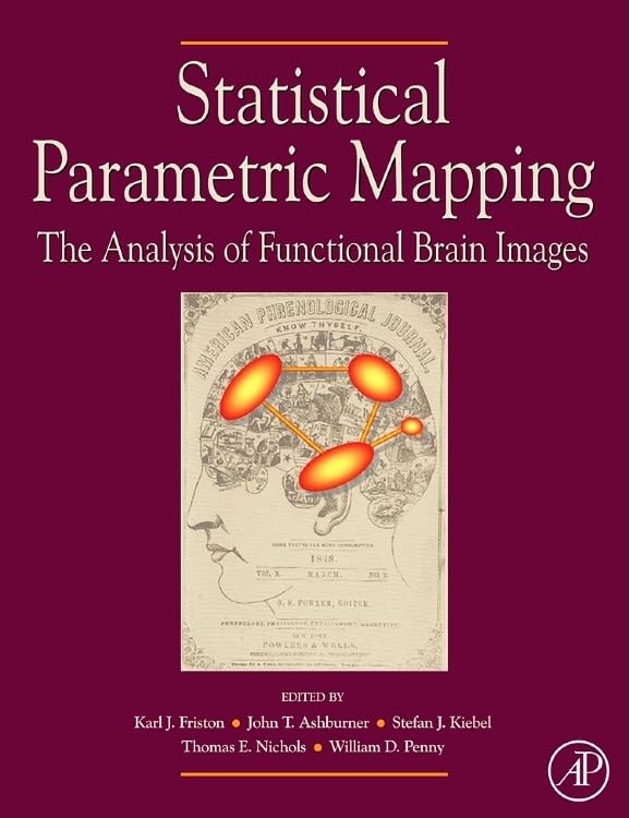 Statistical Parametric Mapping The Analysis Of Functional Brain Images 6388