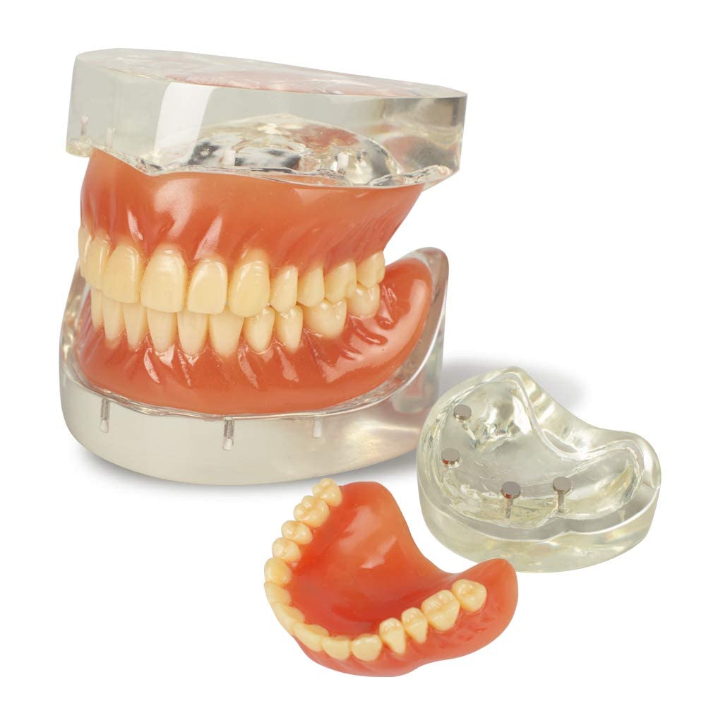 Amazon.com: Teeth Demonstration Model Adult Standard with Removable ...