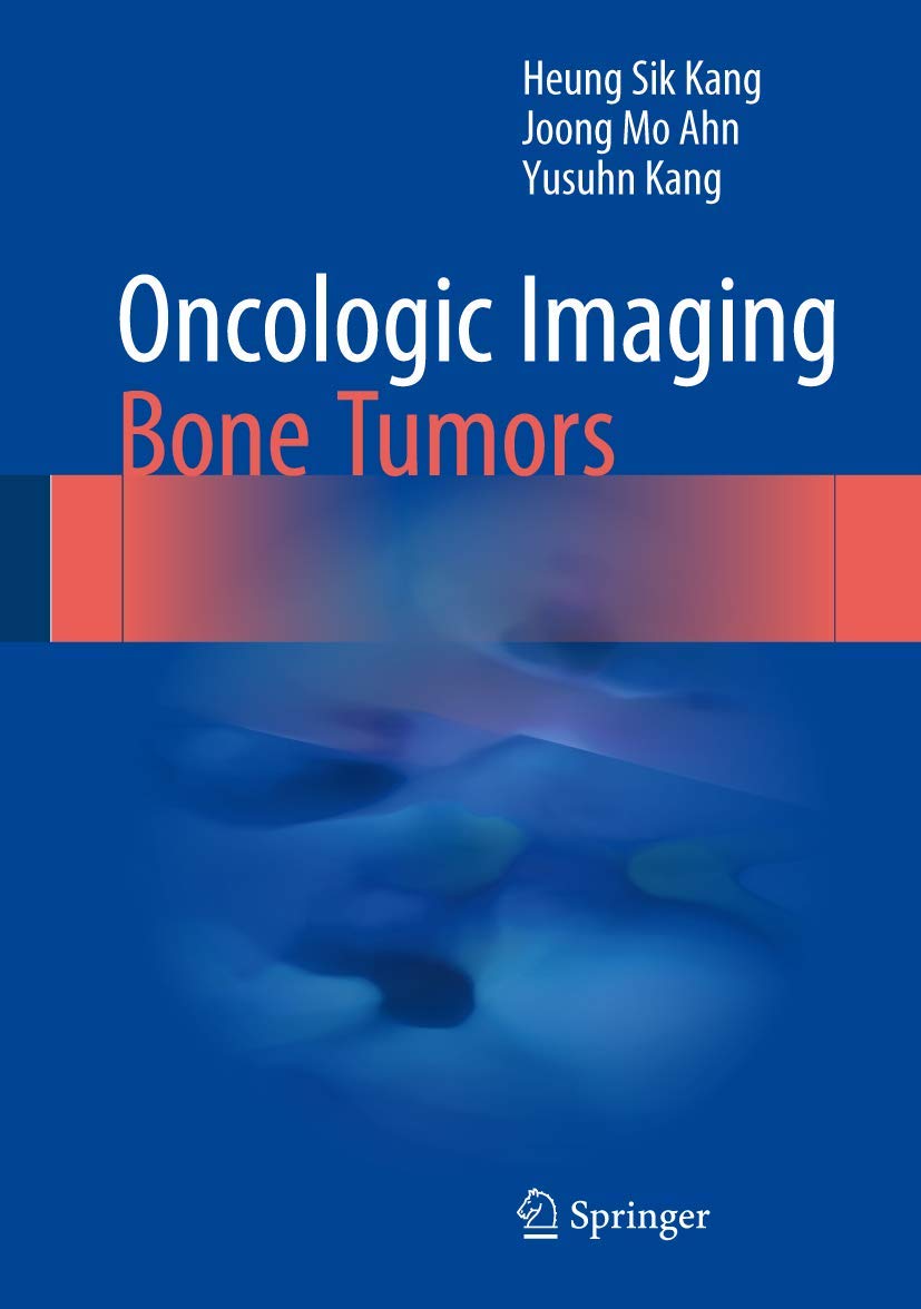 Oncologic Imaging: Bone Tumors: 9789812877024: Medicine & Health ...