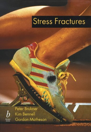 Stress Fractures: 9780867930153: Medicine & Health Science Books ...