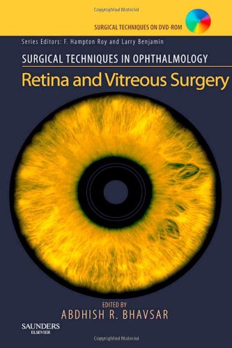 Retina and Vitreous Surgery: Text with DVD : Buy Online at Best Price ...