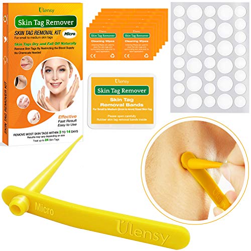 15 Best Skin Tag Removers You Can Use Easily At Home – 2022