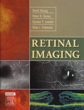 Amazon.com: Retinal Imaging: 9780323023467: David Huang, Peter K ...