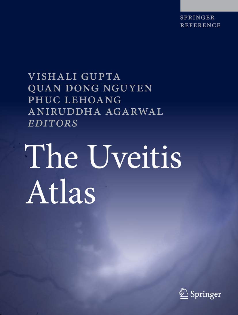The Uveitis Atlas: 9788132224099: Medicine & Health Science Books ...
