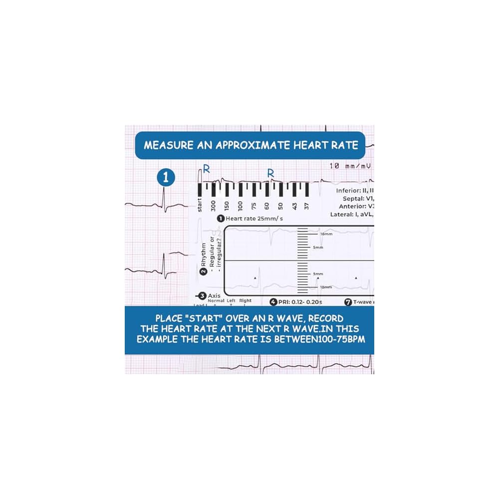 ECG 7 Step Ruler, Portable ECG Ruler Transparent Philippines | Ubuy