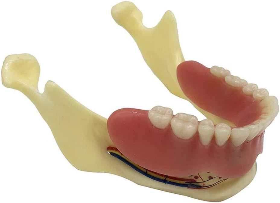 Amazon.com: KH66ZKY Dental Implant Model Dental Lower Jaw Teeth Study ...