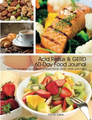 Acid Reflux and GERD 60-Day Food Journal: Saiers, Daniel: 9781514239988 ...