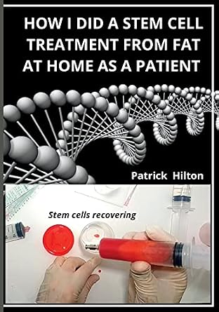 HOW I DID A STEM CELL TREATMENT FROM FAT AT HOME AS A PATIENT: Hilton ...