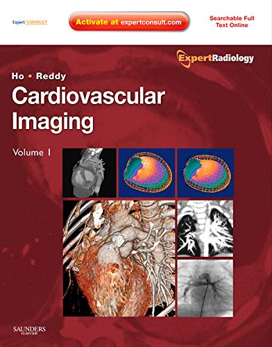 Cardiovascular Imaging, 2-Volume Set: Expert Radiology Series Expert ...