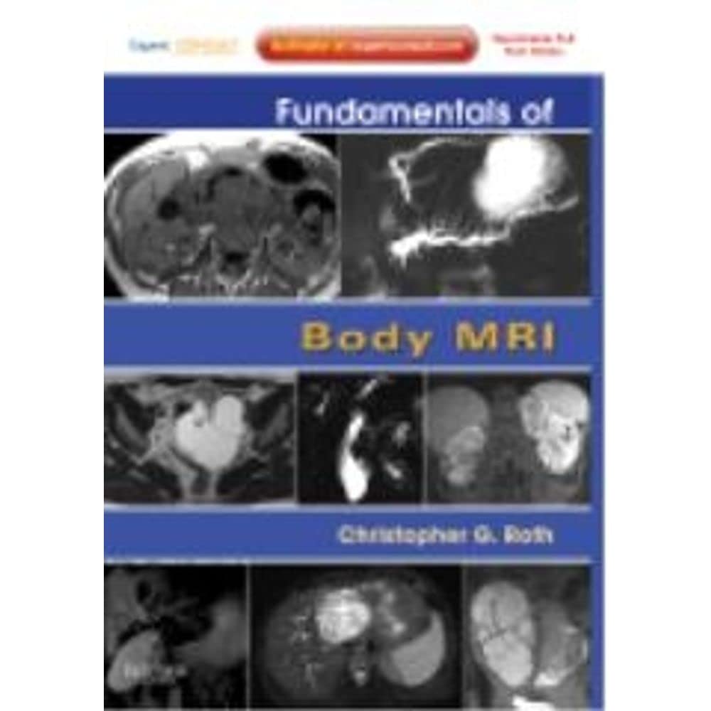 Fundamentals of Body MRI: Expert Consult- Online and Print: Roth MD ...