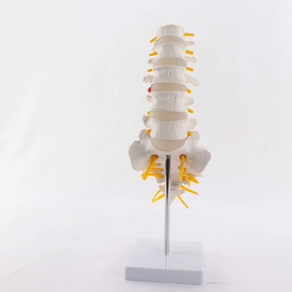 Anatomical Model Of Lumbar Spine 1 1 Model Of Skeletal | Desertcart Japan