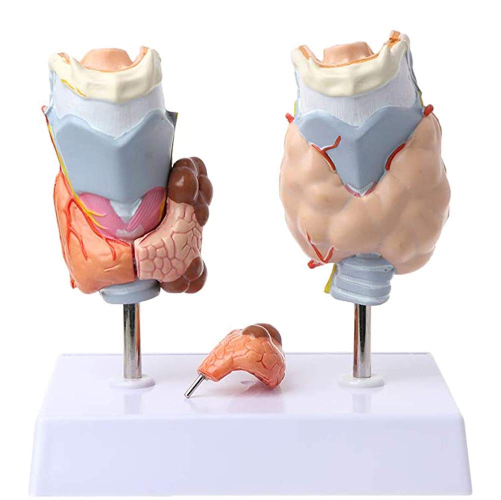Buy Human Anatomical Model-Thyroid Pathology Model-Goiter Retention ...