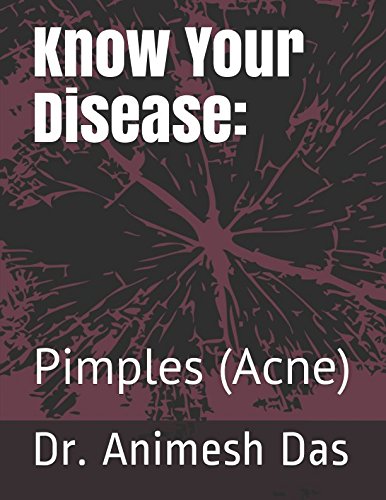 Amazon.com: Know Your Disease: Pimples (Acne): 9781520422879: Das, Dr ...