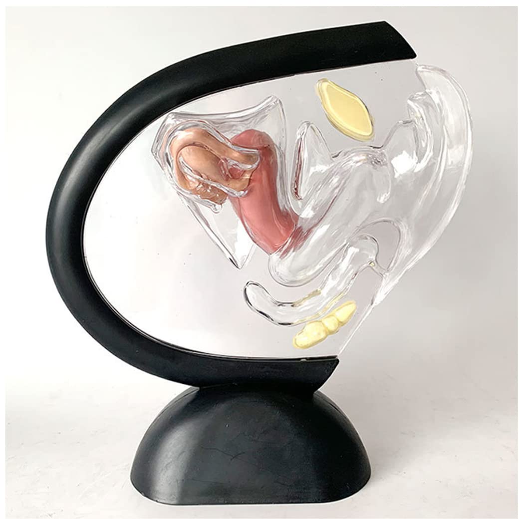 Xsxq Female Reproductive System Model Transparent Uterus Model Ovary ...