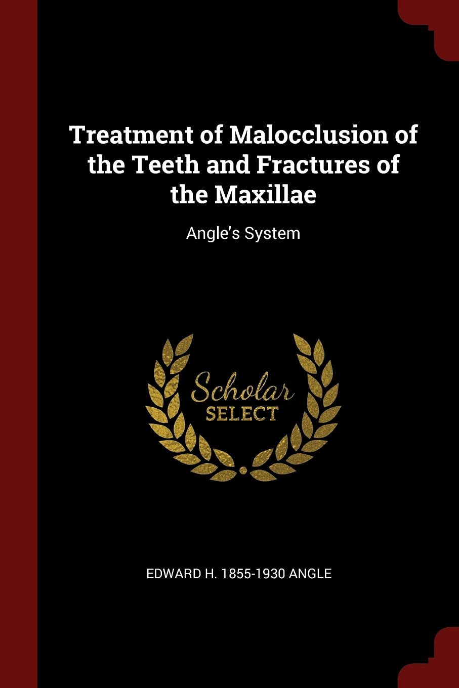 Buy of Malocclusion of the Teeth and Fractures of the Maxillae: Angle's ...