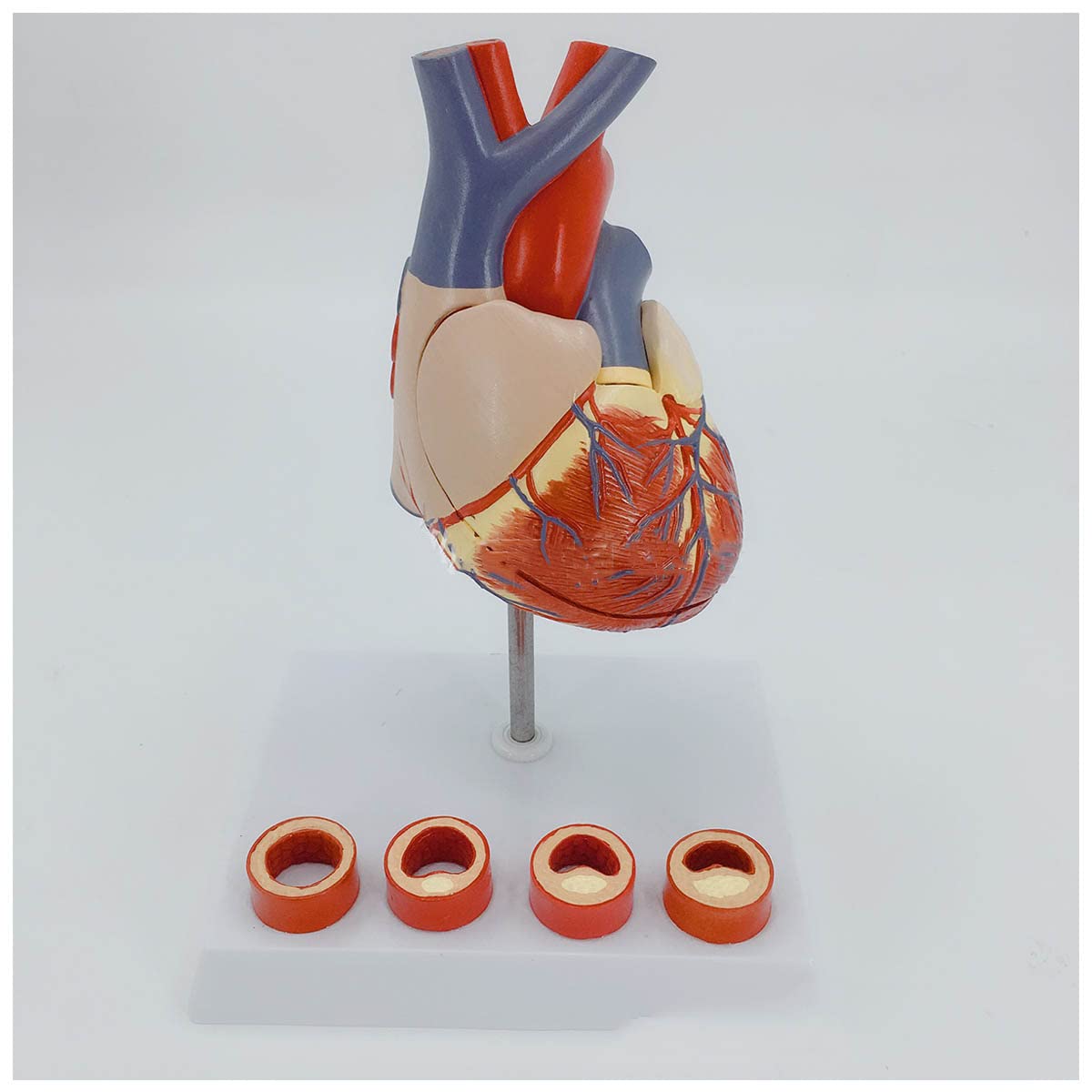 Buy Human Heart Anatomical Model with Thrombus Model Heart Magnified ...