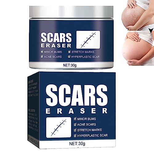 Vergetures : nos conseils pour s’en débarrasser - ELLE.be