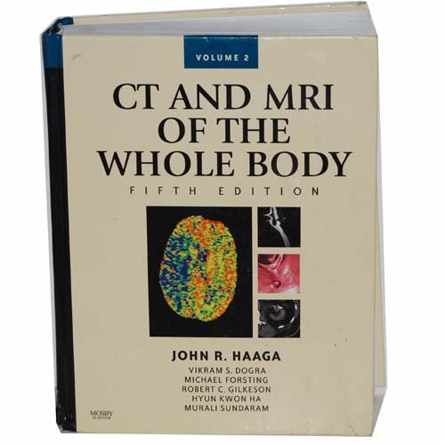 CT and MRI of the WHOLE BODY (Volume 2): Vikram S. Dogra John R. Haaga ...