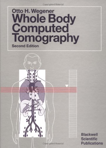 Whole Body Computed Tomography: 9780865422230: Medicine & Health ...