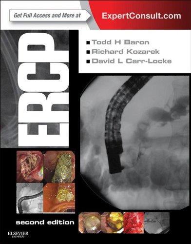 Amazon.com: ERCP E-Book eBook : Baron, Todd H., Kozarek, Richard A., Carr-Locke, David Leslie: Books