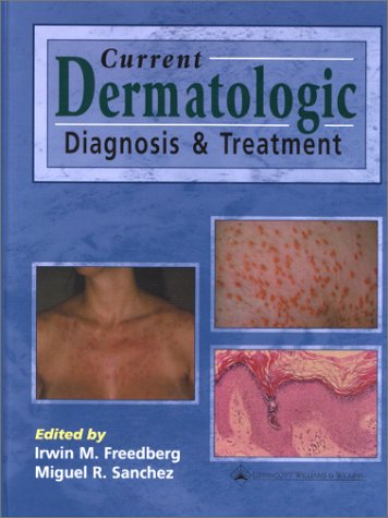 Current Dermatologic Diagnosis and Treatment: 9780387571584: Medicine ...