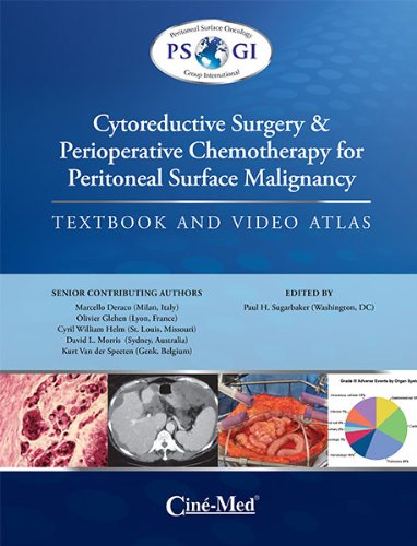 Cytoreductive Surgery & Perioperative Chemotherapy for Peritoneal ...