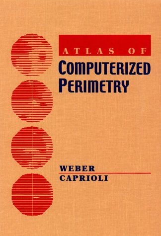 Atlas of Computerized Perimetry: 9780721667379: Medicine & Health ...