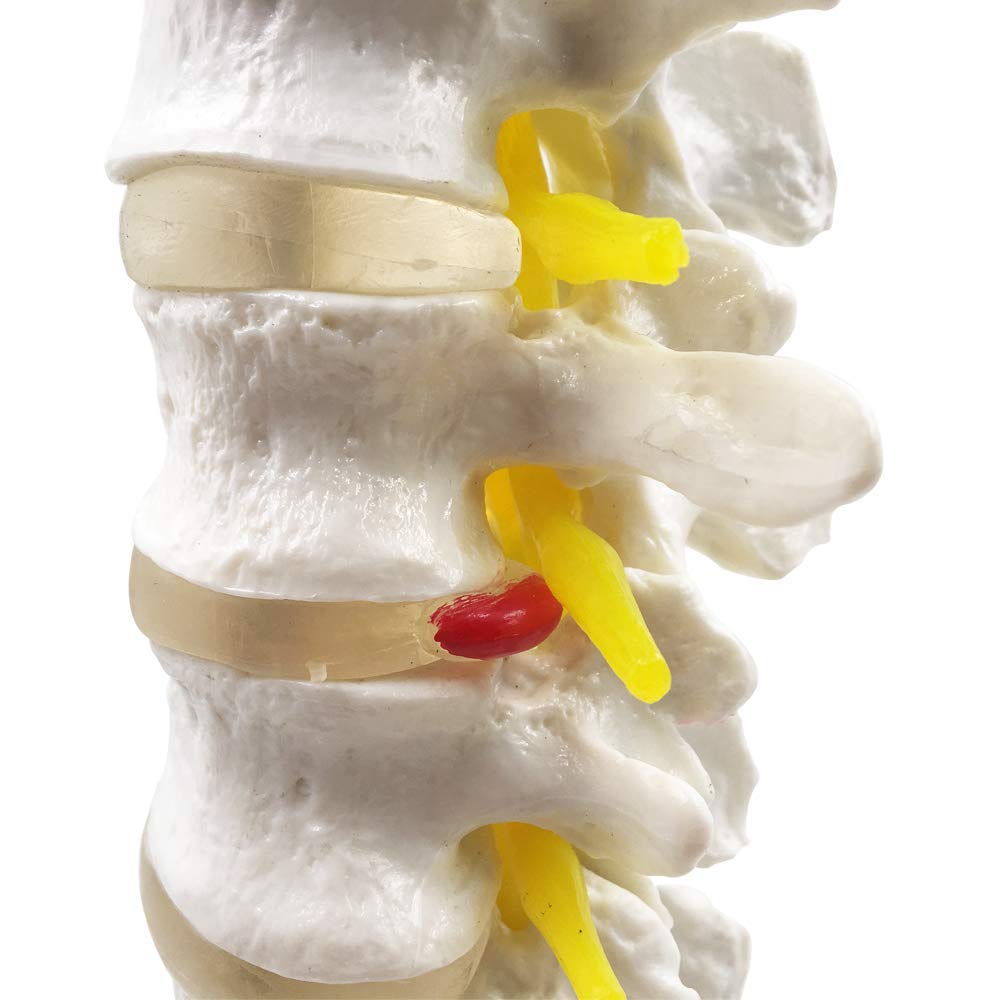 Doctor With Human Spine Anatomy Model. Spinal Cord Disorder And Disease