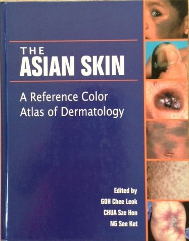 The Asian Skin: A Reference Color Atlas Of Dermatology: 9780071241199 ...