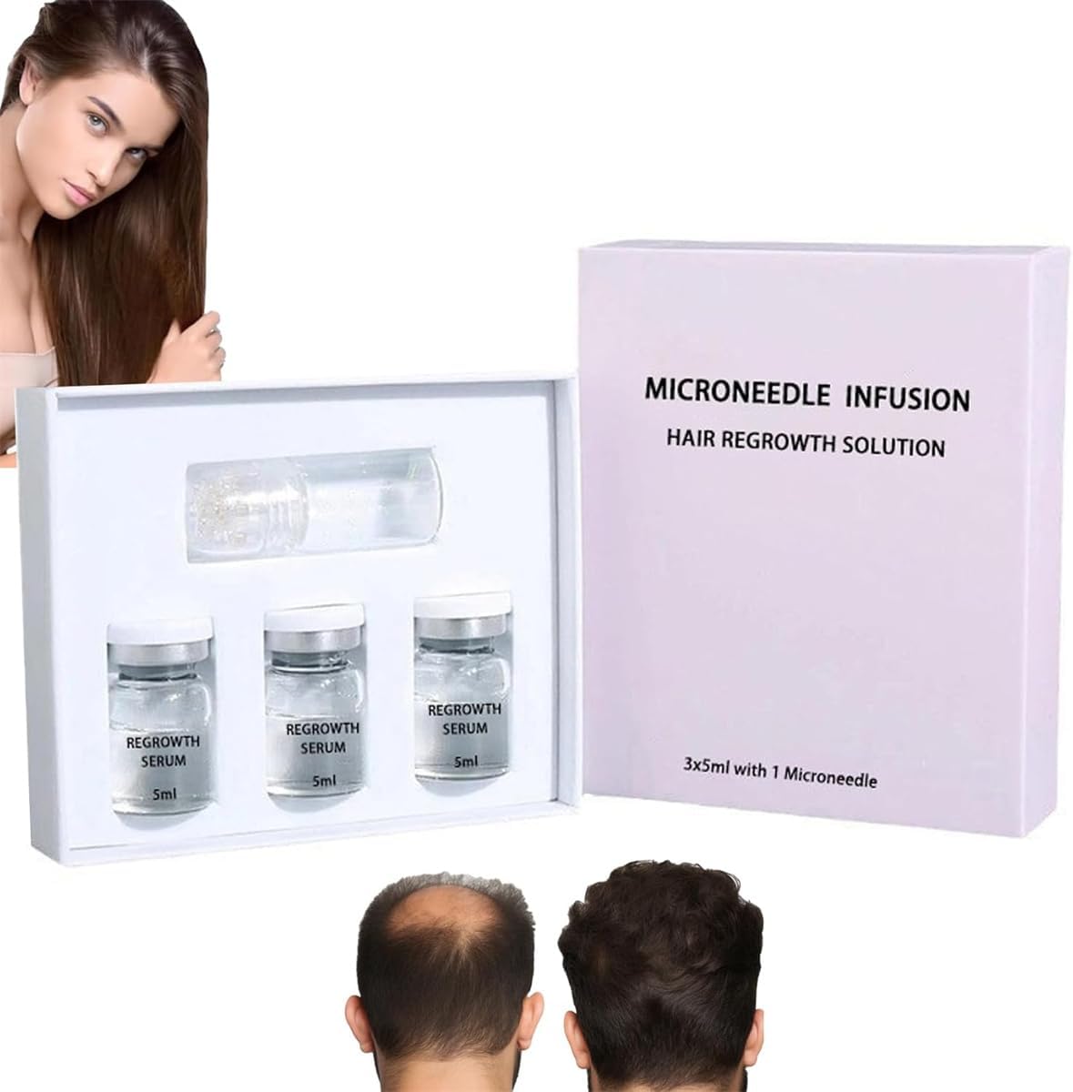AlphaInfuse Hair Regrowth System - ALPHA INFUSE Microneedle Infusion ...