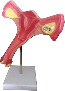 Medical Anatomical Model of Uterine Ovarian - Anatomical Model of ...