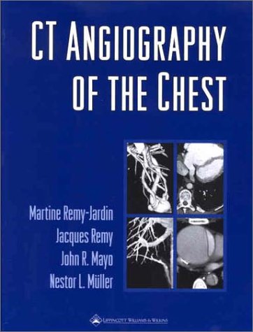 Buy CT Angiography of the Chest Book Online at Low Prices in India | CT ...