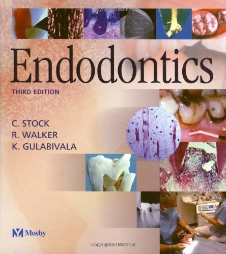 Endodontics: 9780723432036: Medicine & Health Science Books @ Amazon.com