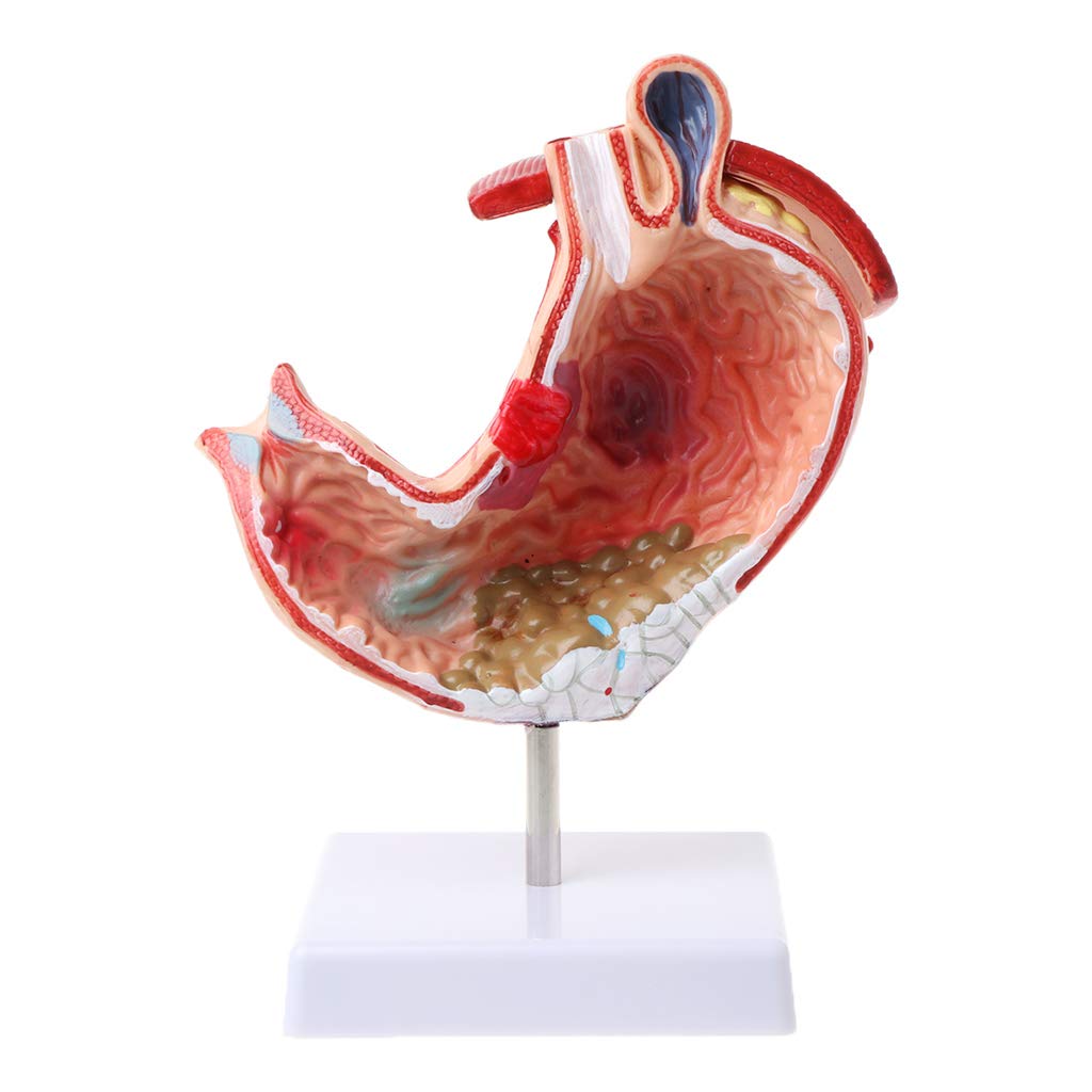Buy KERDEJAR Stomach Anatomy Model,Human Anatomical Anatomy Stomach ...