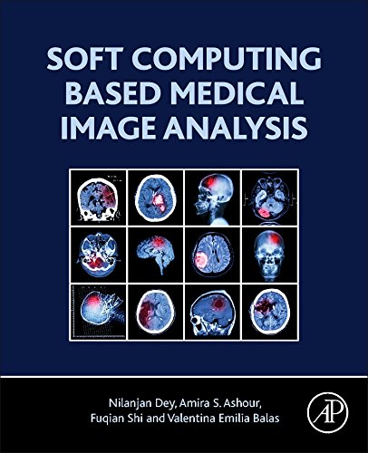 Buy Soft Computing Based Medical Image Analysis Book Online at Low ...